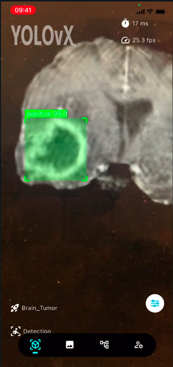 Experiment 3: Brain Tumor Detection on YOLOvX App - General - YOLOvX Forum