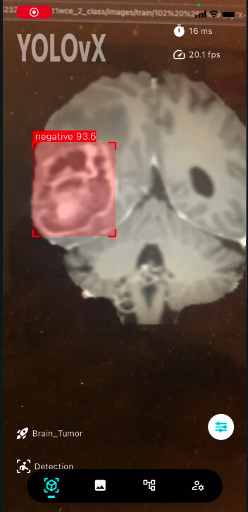 Experiment 3 Brain Tumor Detection On Yolovx App General Yolovx Forum